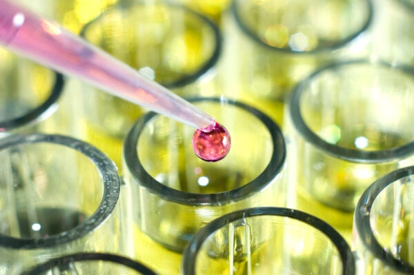 Cholestaseparameter - Facharztwissen