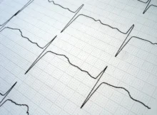 Dressler Syndrom - Facharztwissen