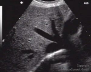 Sonographie - Facharztwissen