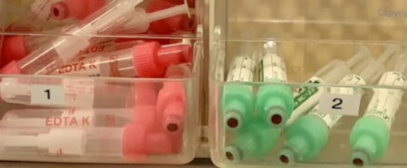 Tumormarker CA72-4 - Facharztwissen