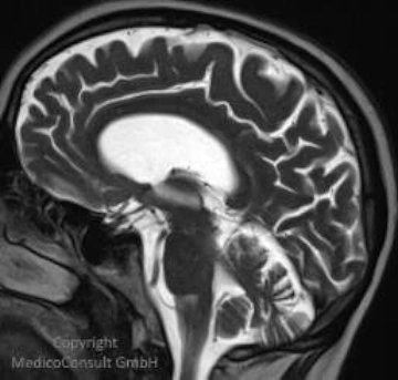 Lithium in der Medizin - Facharztwissen