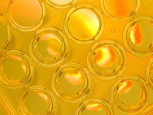 rT3 (reverses Trijodthyronin) und Low-T3-Syndrom - Facharztwissen